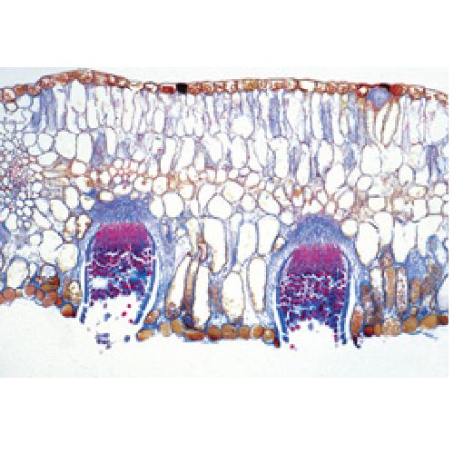 Cryptogamae Supplementary Set Ii - English Slides | Health and Care