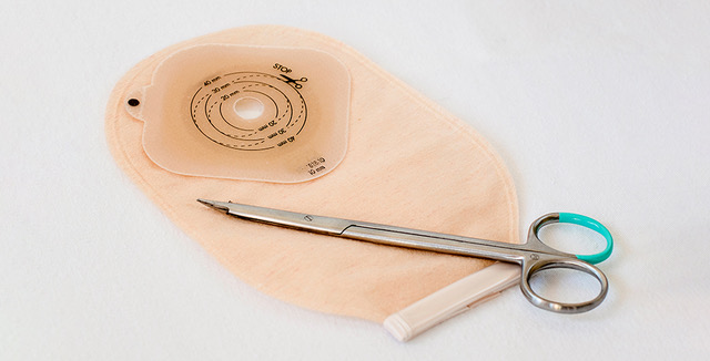 A Guide to Living With a Stoma | Health and Care