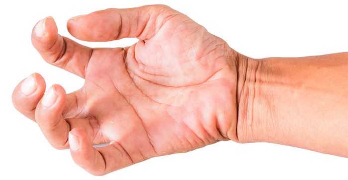 SaeboStretch Hand Splint | Health and Care