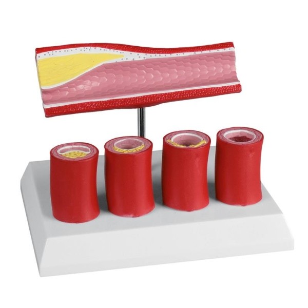 Detailed Model Artery | Health and Care