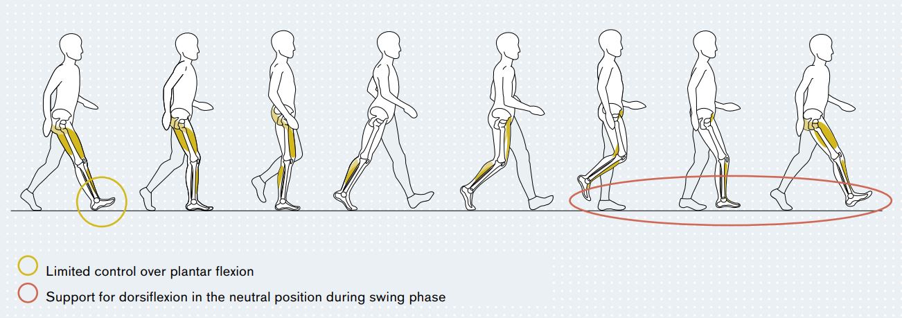 Ottobock WalkOn Reaction Ankle and Foot Orthosis | Health and Care