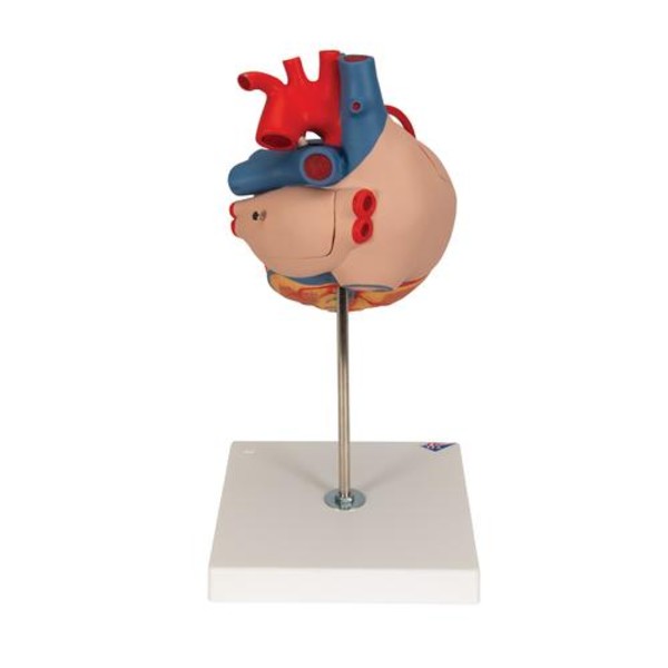 Human Heart with Bypass Anatomical Model | Health and Care