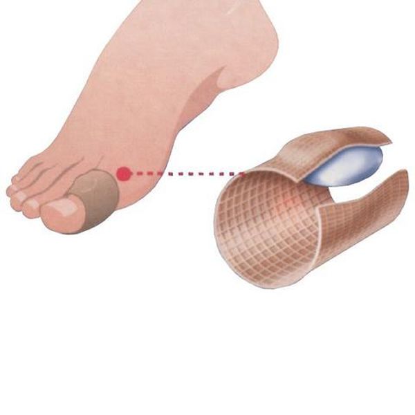 JuraGel Elastic Toe Sheath | Health and Care