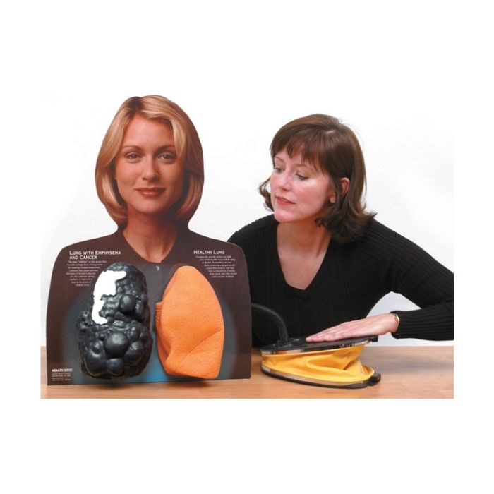 Lou Wheeze Smokers Lungs Comparison Model | Health and Care