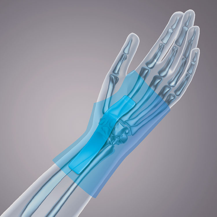 Oppo Stabilised Wrist Support Splint | Health and Care