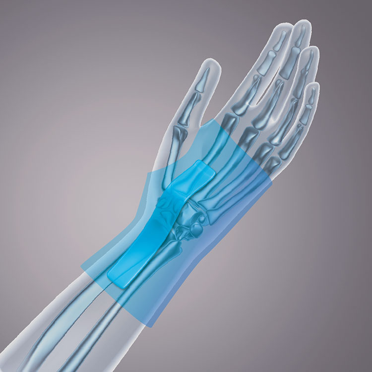 Oppo Health Wrist Support Splint (RH302) | Health and Care