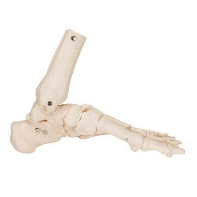Loose Foot Skeleton | Health and Care