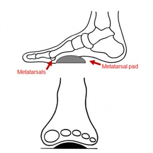 Metatarsal Pads | Health and Care