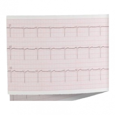 Seca CardioPad-2 ECG Thermal Printer Paper | Health and Care
