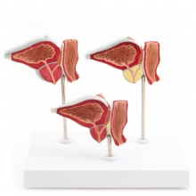 Urology Models | Health and Care