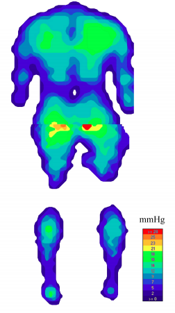 Treat-Eezi Community Pressure Relief Overlay | Health and Care